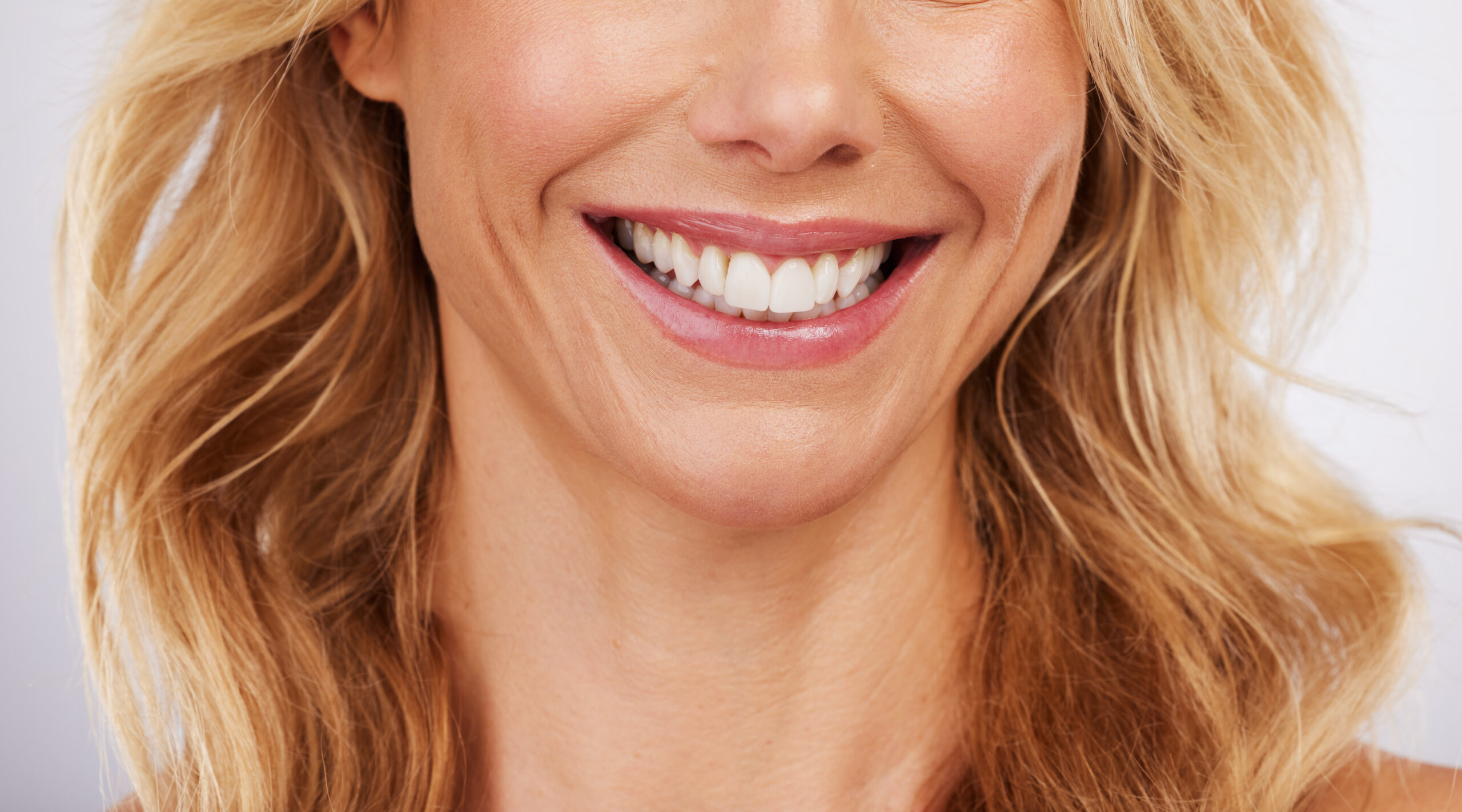 Reinvent Your Smile With Porcelain Veneers | Ankeny, IA