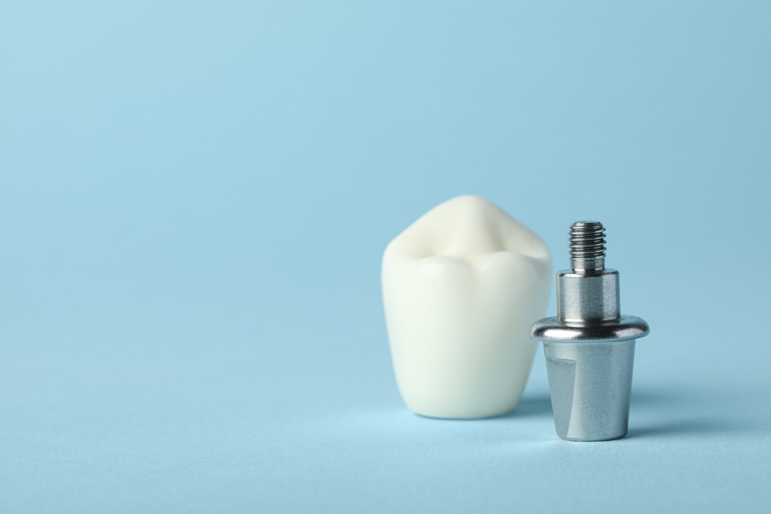 Creating Your Custom Dental Crowns | Ankeny, IA