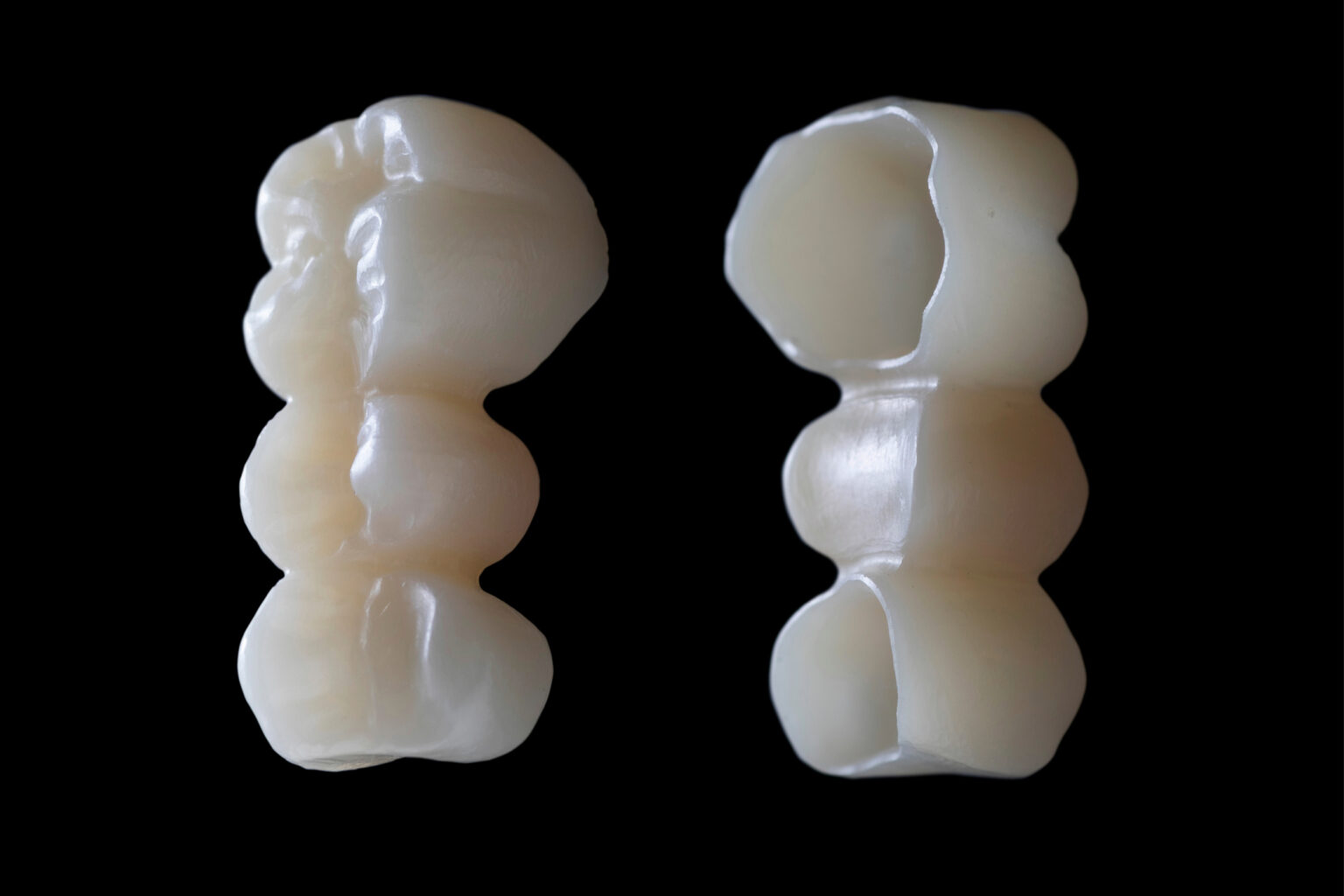 Dental Bridges Provide Full Smiles | Ankeny, IA