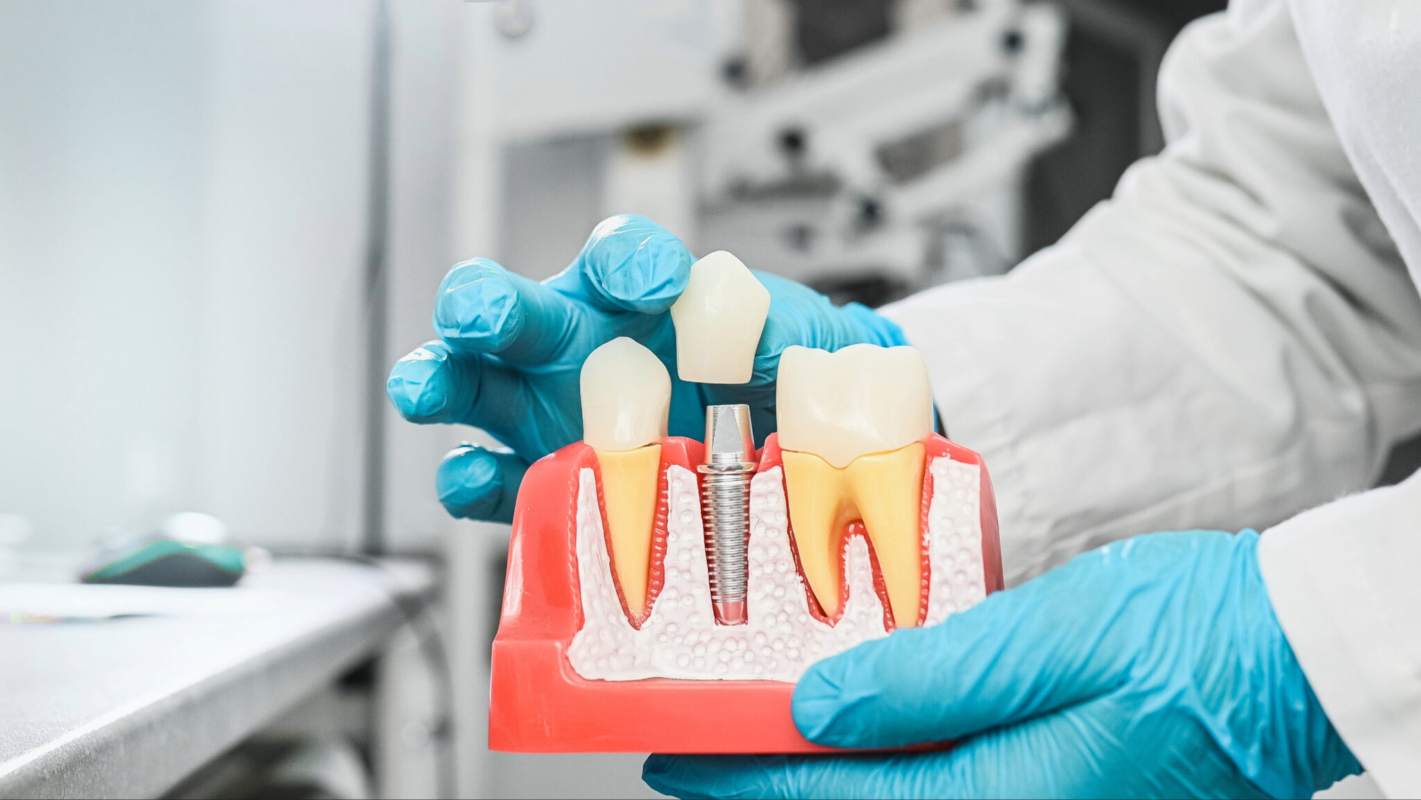 What Makes Dental Implants Different? | Ankeny, IA